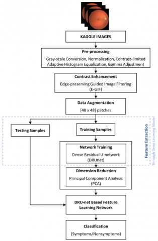 A New Early Stage Diabetic Retinopathy Diagnosis Model Using Deep ...