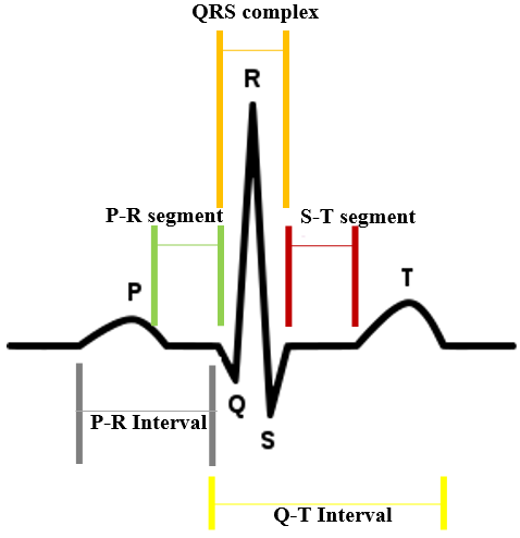 ConvNet: 1D-Convolutional Neural Networks for Cardiac Arrhythmia ...