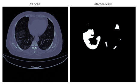 Different Deep Learning Based Classification Models for COVID-19 CT-Scans and Lesion ...
