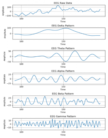 DM-EEGID: EEG-Based Biometric Authentication System Using Hybrid Attention-Based LSTM and MLP ...