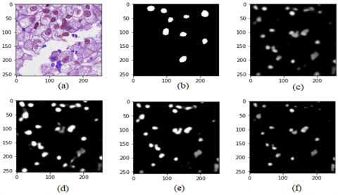Biomedical Image Segmentation with Modified U-Net | IIETA