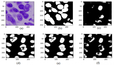 Biomedical Image Segmentation with Modified U-Net | IIETA
