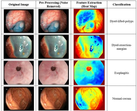 Se-Resnet: A Novel Method for Gastrointestinal (GI) Diseases ...