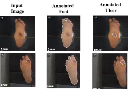 Utilizing Mask R-CNN for Automated Evaluation of Diabetic Foot Ulcer Healing Trajectories: A ...