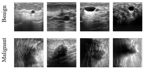Hybrid Feature Selection Using the Firefly Algorithm for Automatic ...