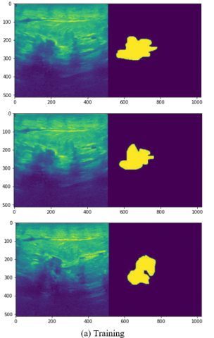 Hybrid Feature Selection Using the Firefly Algorithm for Automatic ...