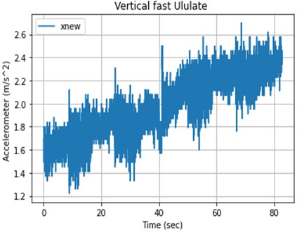 Ululate: A Non-Intrusive, Wearable Tongue Gesture Detection System for ...