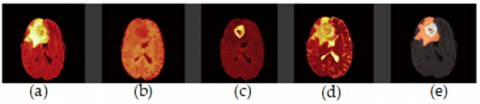 Medical Image Segmentation Using Enhanced Residual U-Net Architecture | IIETA